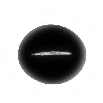 Steam Community Market :: Listings for X-Ray